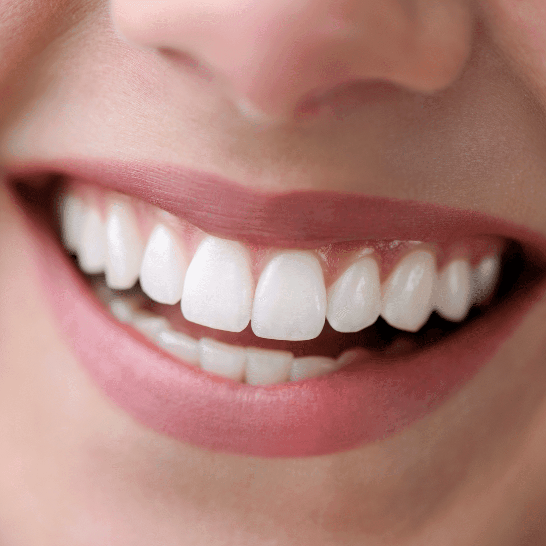 Dental Implant Treatment - Share A Smile