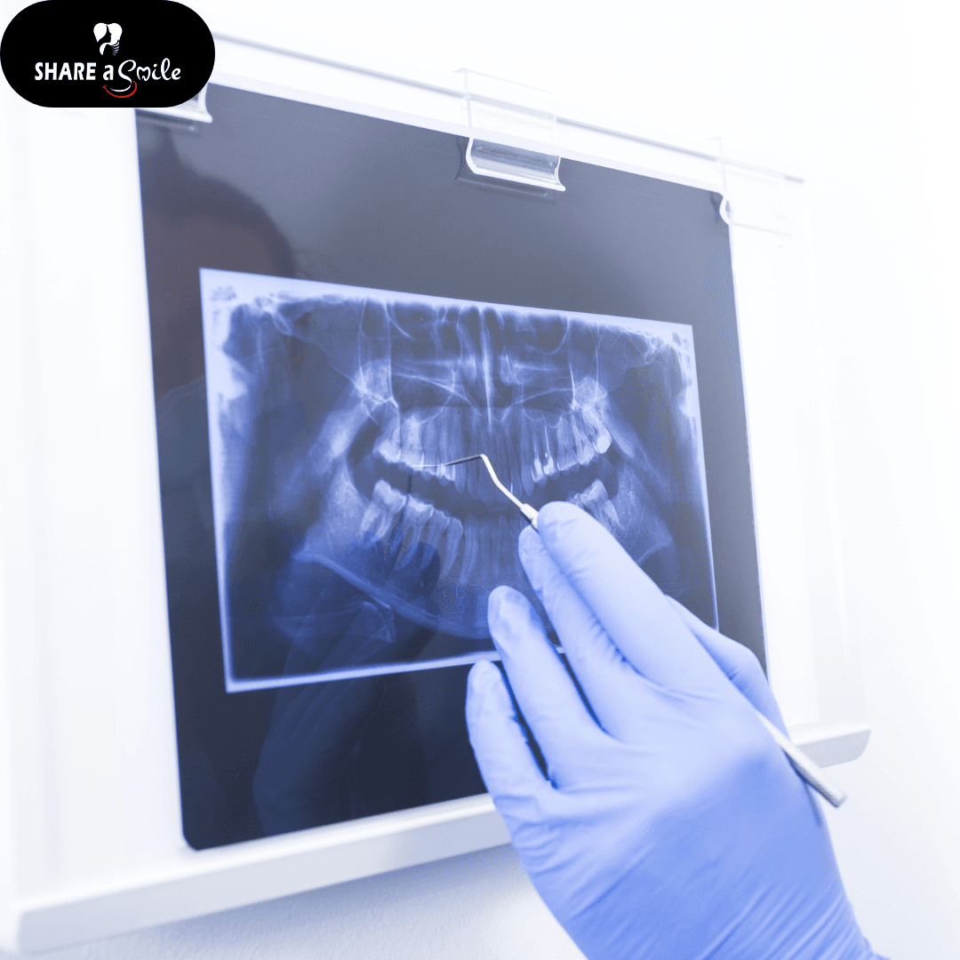 Understanding the Vital Role of Dental X-Rays in Oral Health Care